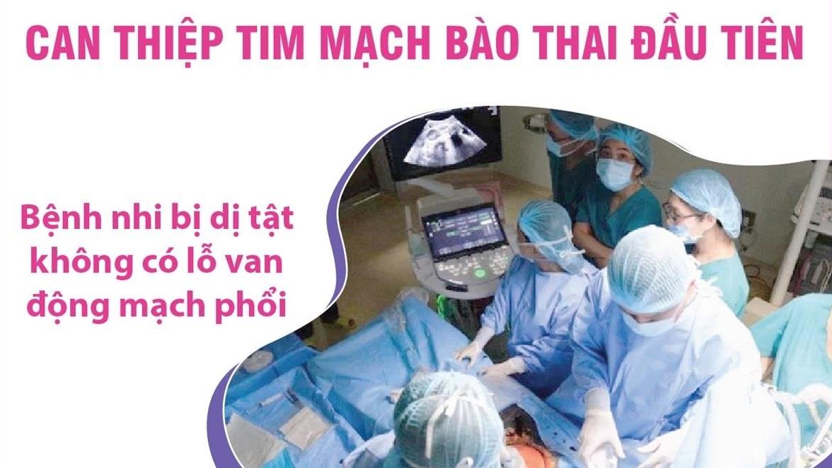 Việt Nam ghi dấu ấn mới trong kỹ thuật can thiệp tim mạch bào thai đầu tiên